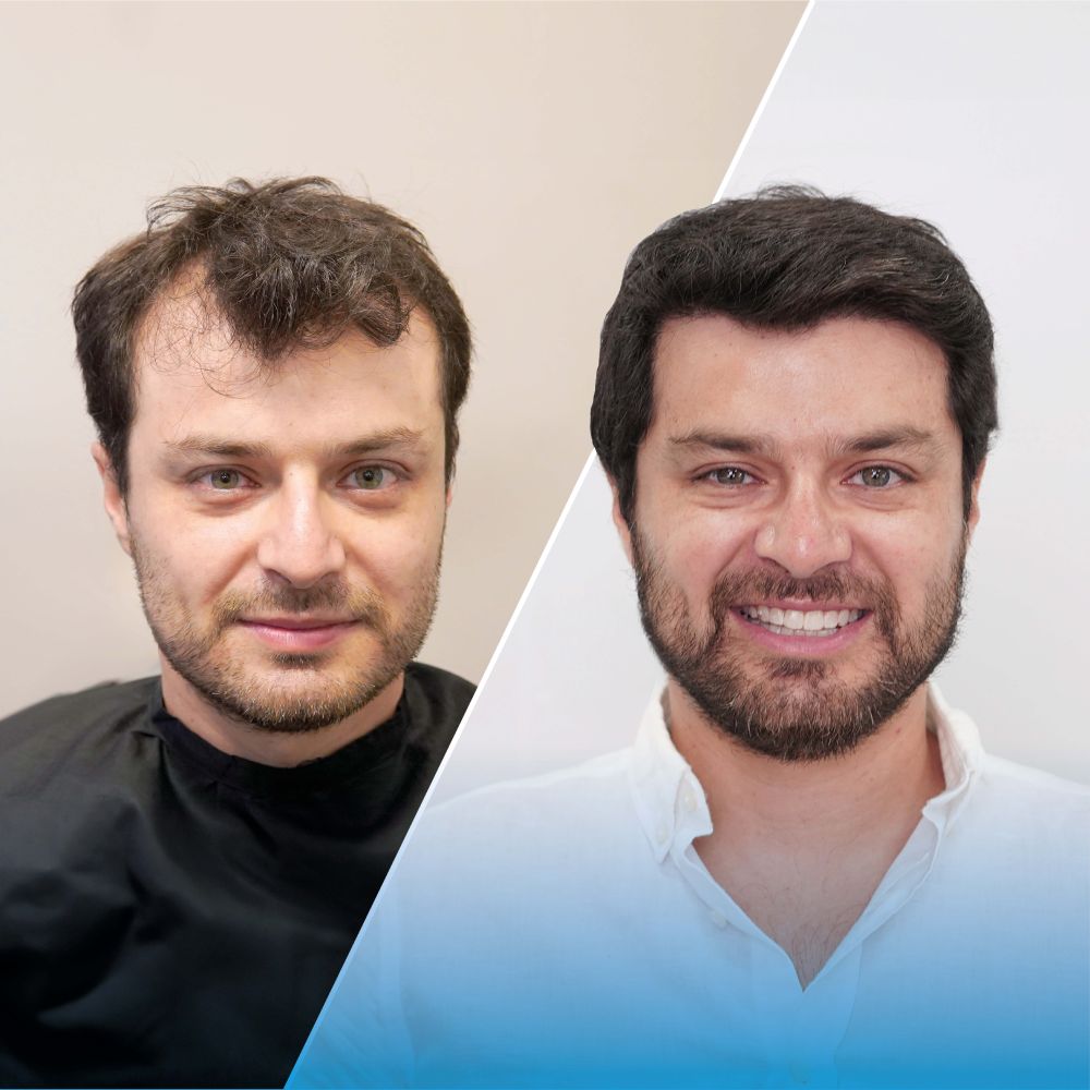 Home EN - Thiago Bianco